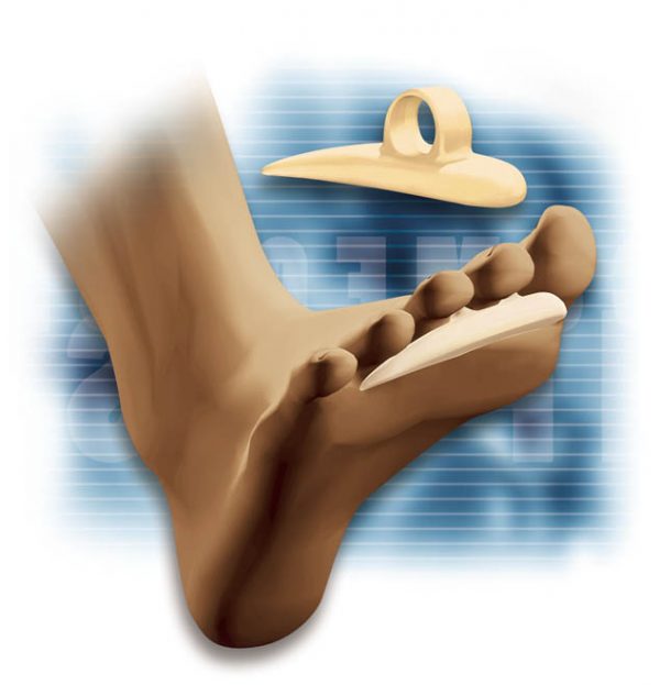 CC226 Luga Toe Crest with Reinforced Loop - Ortho Active